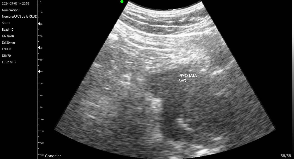 Ultrasonido y Medicina - Drs QUEZADA
